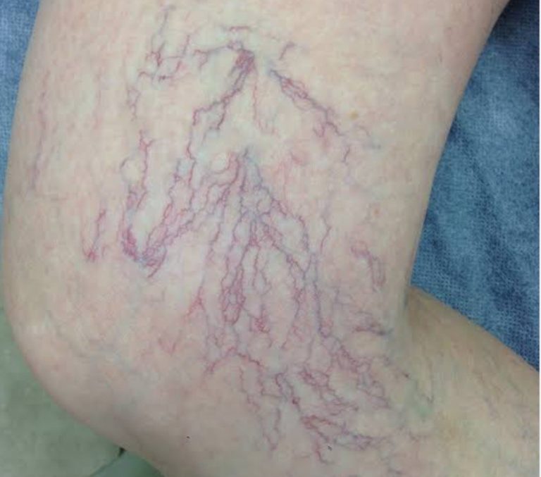 Drummoyne Varicose Vein Clinic - Face and Eye Aesthetics